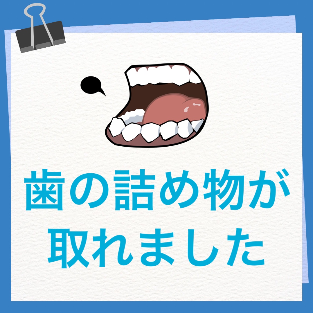 歯の詰め物が取れました 英語で？ 特派員直伝とらべる英会話 | 節約英語学習道 主婦の英語学習日記
